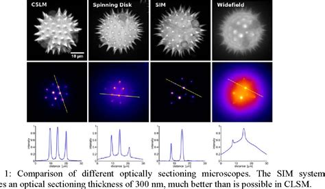 Figure 1 From Flexible Structured Illumination Microscope With A Programmable Illumination Array