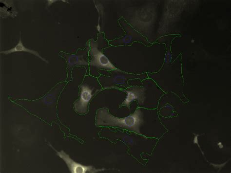intensity measurement problem with cellprofiler image analysis