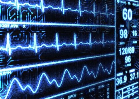 Acls Algorithm Guide Simplify Life Saving Techniques