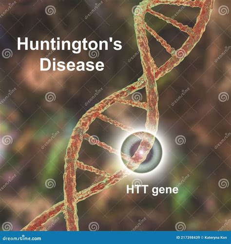 Huntington S Disease A Neurodegenerative Disease Due To Mutation In The Huntingtin Gene Htt