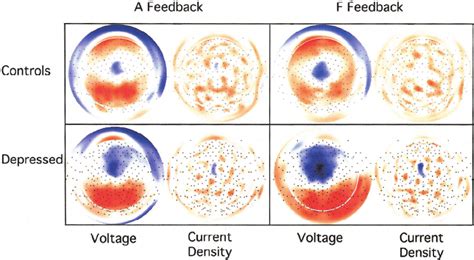 Scalp Topography Of The Averaged Event Related Potentials For Control Download Scientific