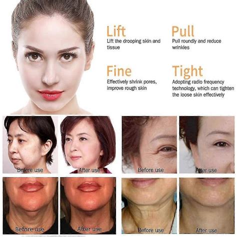 Rf Facial Machine With 2 Face And Eye Probes White Fruugo Uk