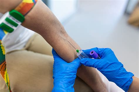 환자를 위한 혈액 그리기 서비스를 하고 있는 의학 기술자 환자에게서 혈액 샘플을 취하는 멸균 고무 장갑을 가진 실험실 조수 2명에 대한 스톡 사진 및 기타 이미지 Istock