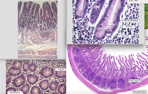 Crypts Of Lieberkuhn Duodenum