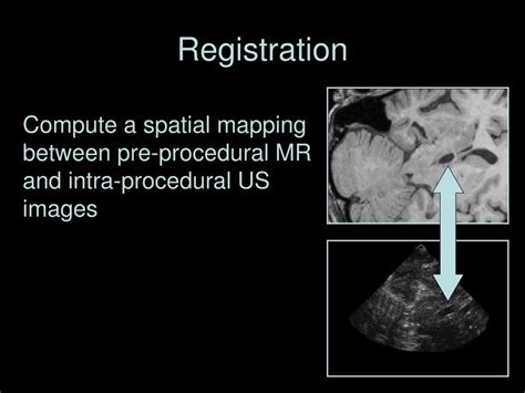Ppt Non Rigid Mr Ultrasound Registration For Neurosurgery Prostate Mrgfus And Brachytherapy