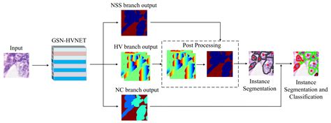 Bioengineering Free Full Text Gsn Hvnet A Lightweight Multi Task Deep Learning Framework