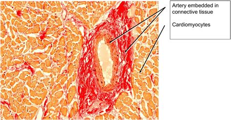 Cardiac Muscle Transverse Papillary Muscle