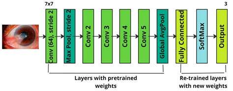 A Performance Evaluation Of Convolutional Neural Network Architectures For Pterygium Detection