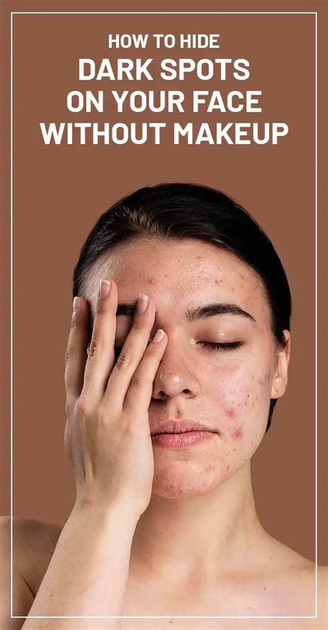 How To Hide Black Spots On Face With Makeup Saubhaya Makeup