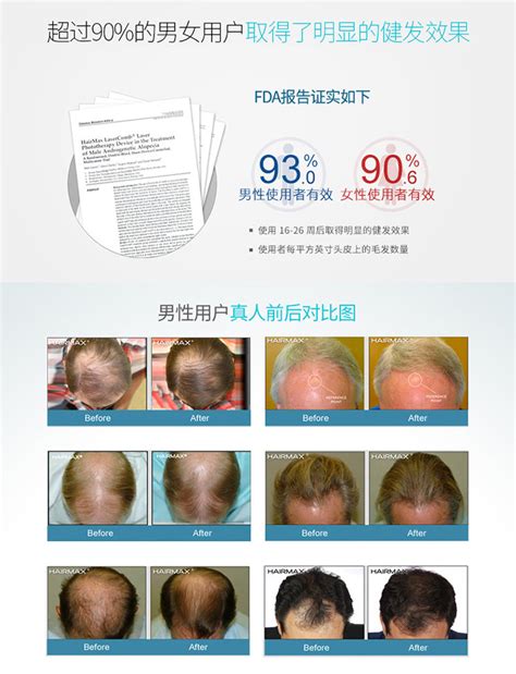 激光生发头盔防脱生发仪生发帽REDLD防脱发刺激毛囊生长密发固发 阿里巴巴