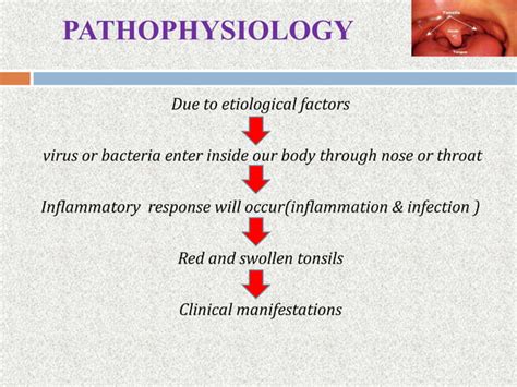 Nursing Management Of The Patient With Tonsillitis Ppt Pptx