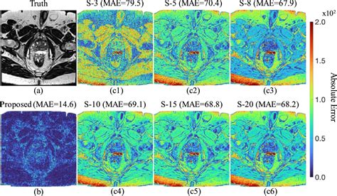 High Resolution Mri Synthesis Using A Data Driven Framework With