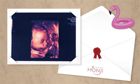 대만타이페이홍지클리닉 난자제공 합법 난자공여 성공 스토리 홍지클리닉의 장원장님 간호사와 모든 스텝들에게 너무 감사드립니다 모두 상냥하고 친절하게 대해 주셨고