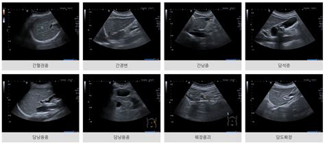상복부초음파 참외과내과 건강검진센터