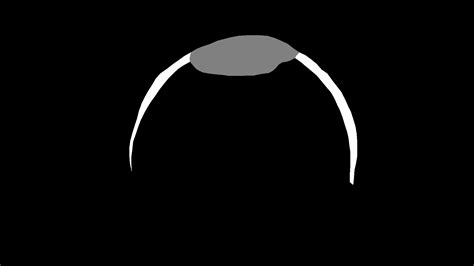 Men Hair Loss Segmentation Dataset 3000 Images — Unidata