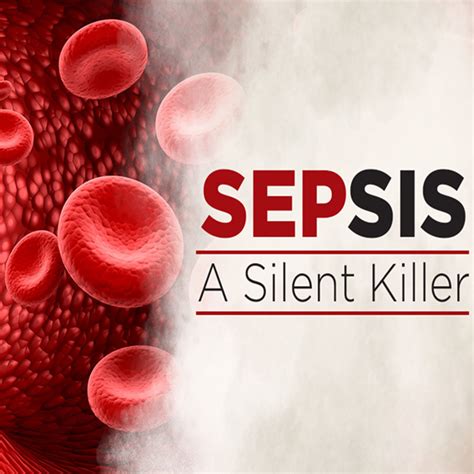 Sepsis How Much Do You Know
