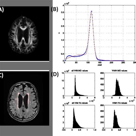 Principals Of Diffusion Tensor Imaging Two Principal Download Scientific Diagram
