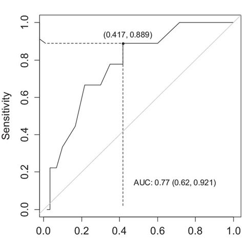 Roc Curve For Aptt Value Predicting Minor Bleeding In Ssm Group