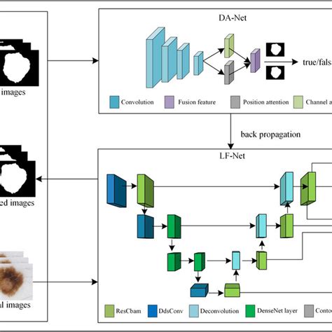 Skin Lesion Segmentation Flow Chart Of The Proposed Jaal Net Download Scientific Diagram