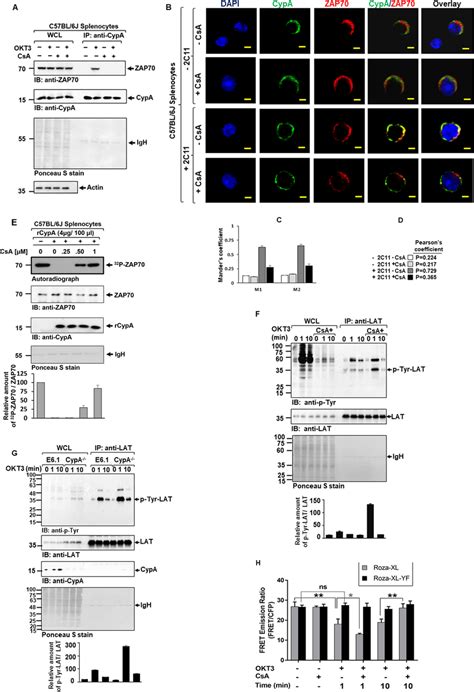 Cypa Ablation Or Its Inhibition By Cyclosporin A Annuls The Effect Of