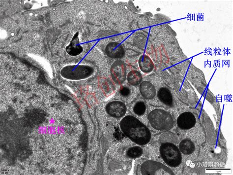透射电镜下的细胞吞菌 海南省生物材料与医疗器械工程研究中心