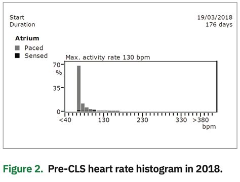 Use Of Closed Loop Stimulation For Rate Responsive Pacing In An Aai