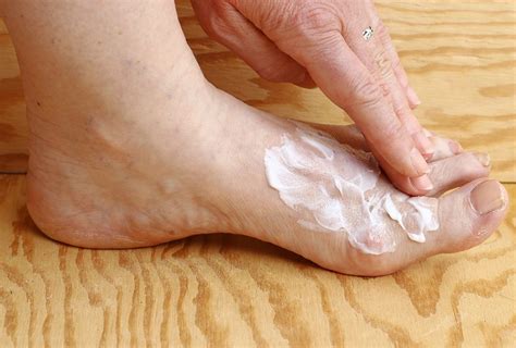 What Is Cutaneous Candidiasis And How Is It Treated