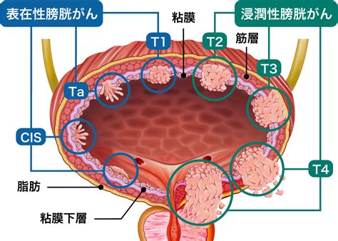 膀胱画像 膀胱 解剖図 Xyfnj