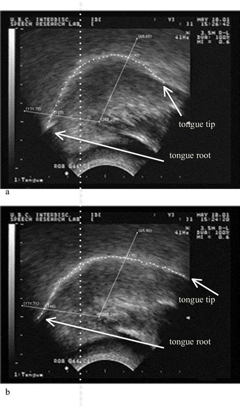 Fang Vowel Formant Means Each Point Represents The Mean Of 6 Download Scientific Diagram