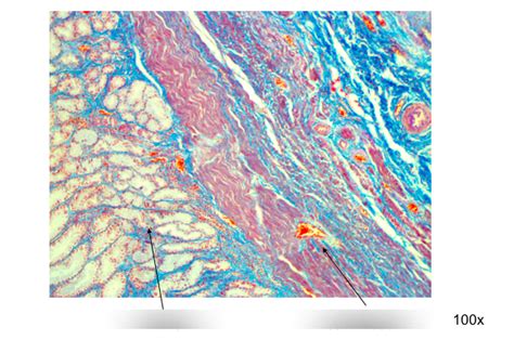Lab Final Diagram Quizlet Lab Final Diagram Quizlet
