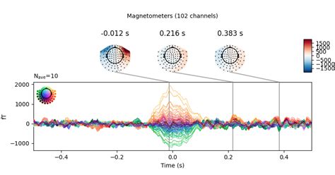 Overview Of Artifact Detection — Mne 0 23 4 Documentation