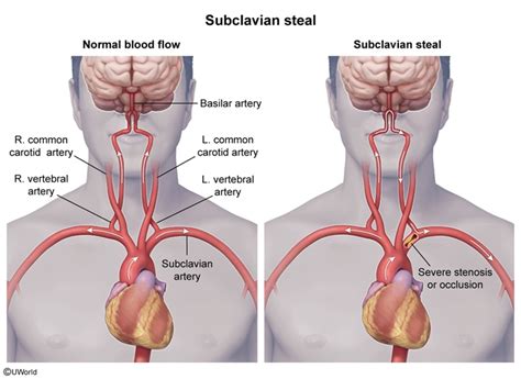 Syncope Cardiology Uworld Medical Library