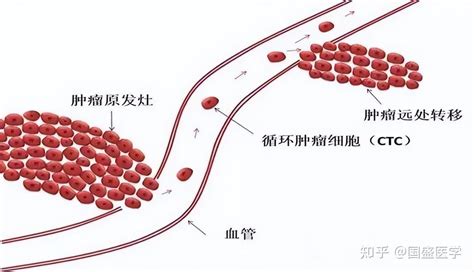 专利保存配方为液体活检之循环肿瘤细胞CTC保驾护航 知乎