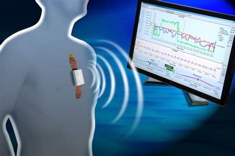 Microcontroller Based Project On Patient Monitoring System