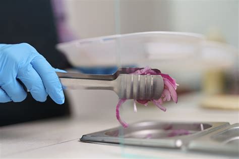 요리사는 부엌의 용기에서 집게로 얇게 썬 붉은 양파를 가져갑니다 그릇에 대한 스톡 사진 및 기타 이미지 그릇 그리스 음식 도시락 Istock