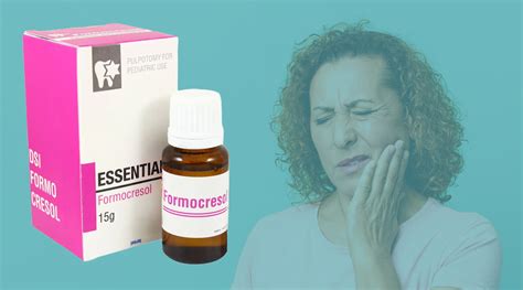 The Multifaceted Role Of Formocresol Liquid In Modern Dental Care Wholedent