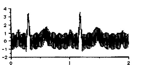 Ecg Corrupted Due To Power Line Interference Many Researchers Have