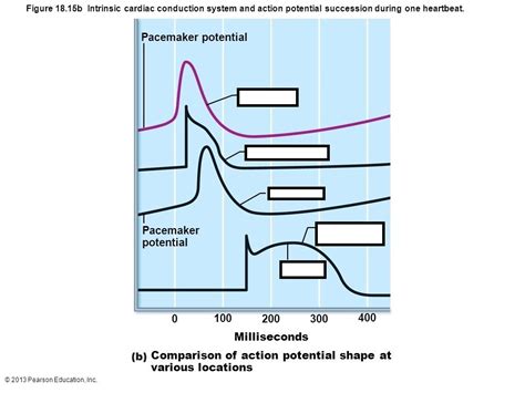Pacemaker Rhythms Diagram Quizlet