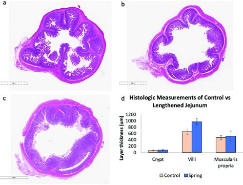 Porcine Jejunum After Spring Mediated Lengthening Maintains Intact
