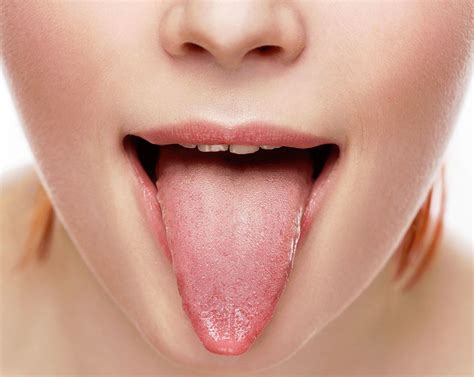Lengua Blanca ⇒ ¡¡ Causas Síntomas Y Tratamiento