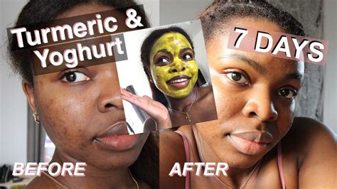 Turmeric And Yogurt Face Mask Review At Janelle Hernandez Blog