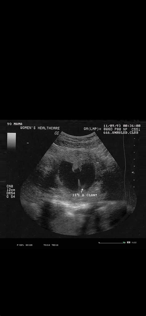 Wu Tang Phone Wallpaper You Can Install This Wallpaper On Your Desktop