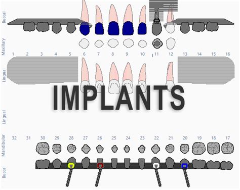 Eaglesoft Clinical Mastery Enhance Dental Workflow Today — The Crew Process