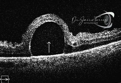 Dr Vincent Iroaganachi On Linkedin Wonders Of Oct Scan Interesting
