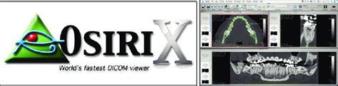 Osirix Md 64 Bit Software For Digital Imaging And Communication For Download Scientific Diagram