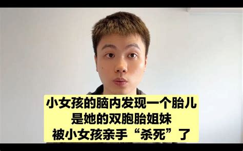 真实的医学案例，小女孩“吃”了她的双胞胎姐妹，装在脑袋里面！ 哔哩哔哩