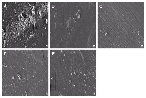 Scanning Electron Microscope Sem Images Showing The Effects Of Download Scientific Diagram