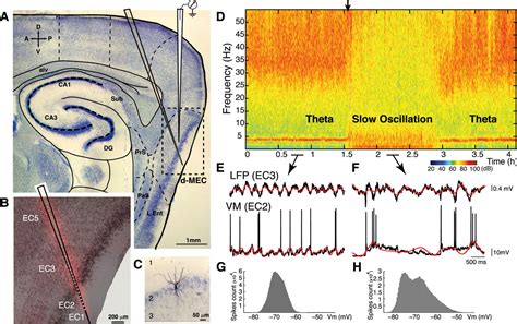 Intrinsic Circuit Organization And Thetagamma Oscillation Dynamics In