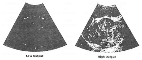 Chapter Pulsed Echo Instrumentation Flashcards Quizlet