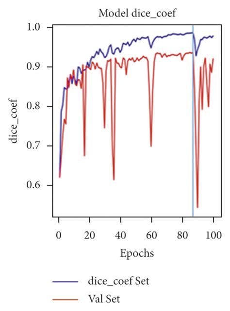 Validation Set Trends Of Loss And Dice Coefficients For Each Method In